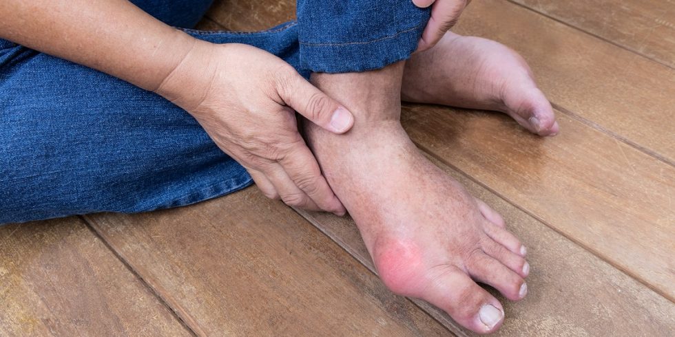 Comment réduire son taux d'acide urique ? - Senior Globe